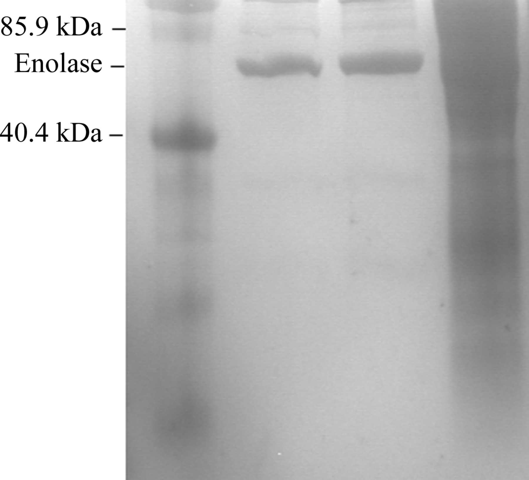 (IUCr) Expression, purification, crystallization and preliminary X-ray ...