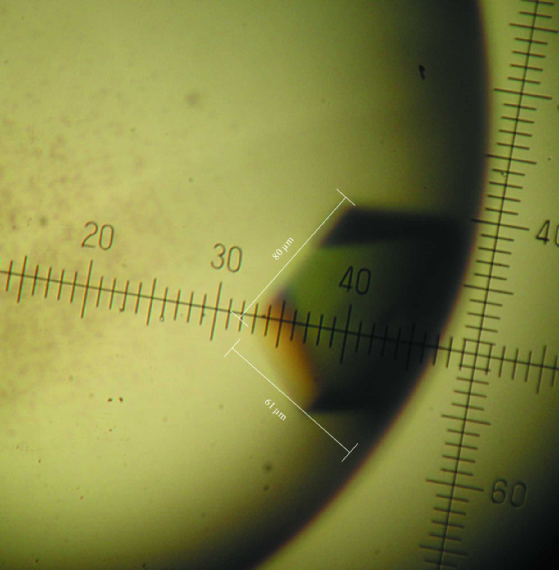 (IUCr) Expression, purification, crystallization and X-ray ...