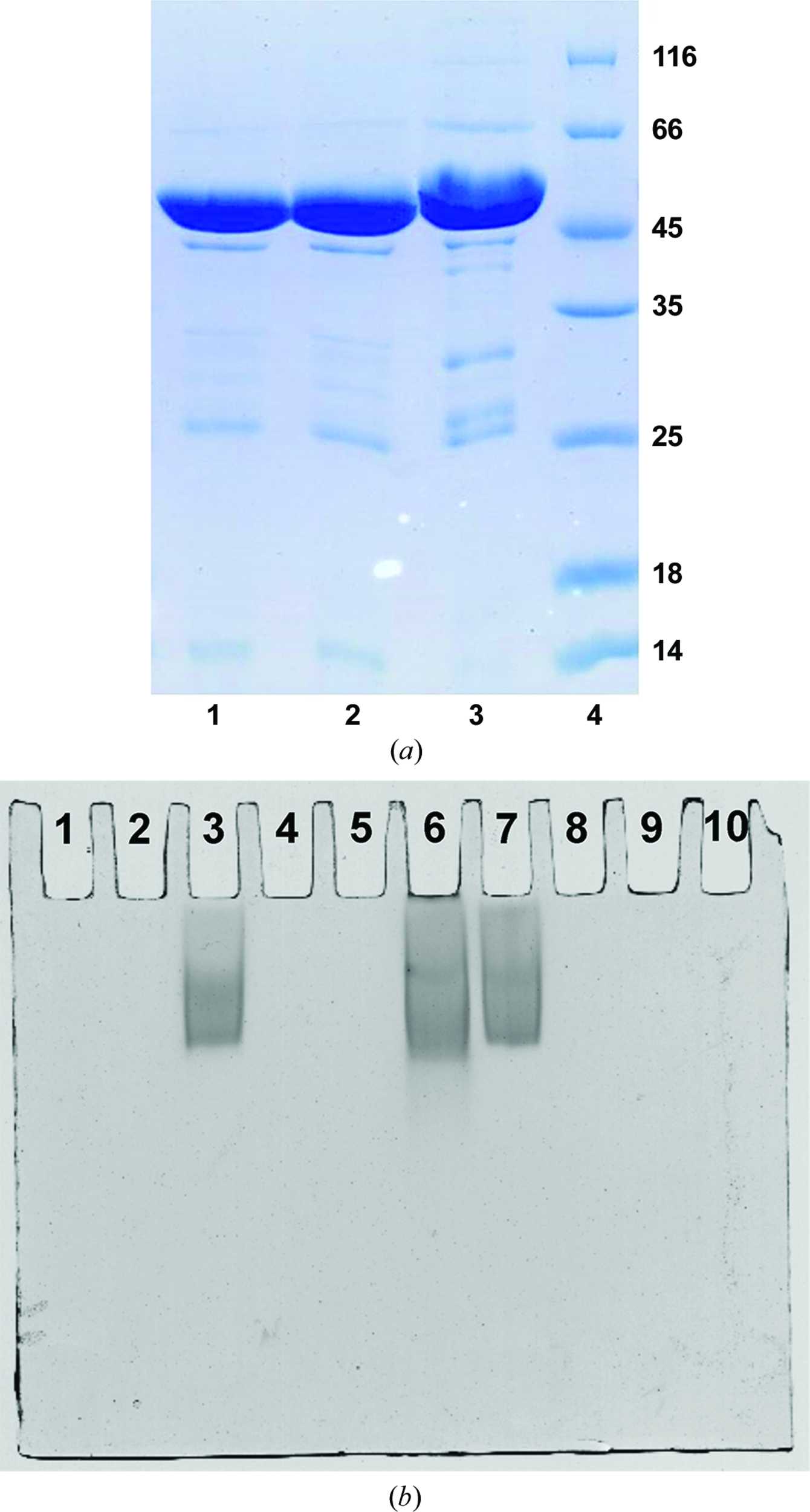(IUCr) Purification, crystallization and X-ray crystallographic ...